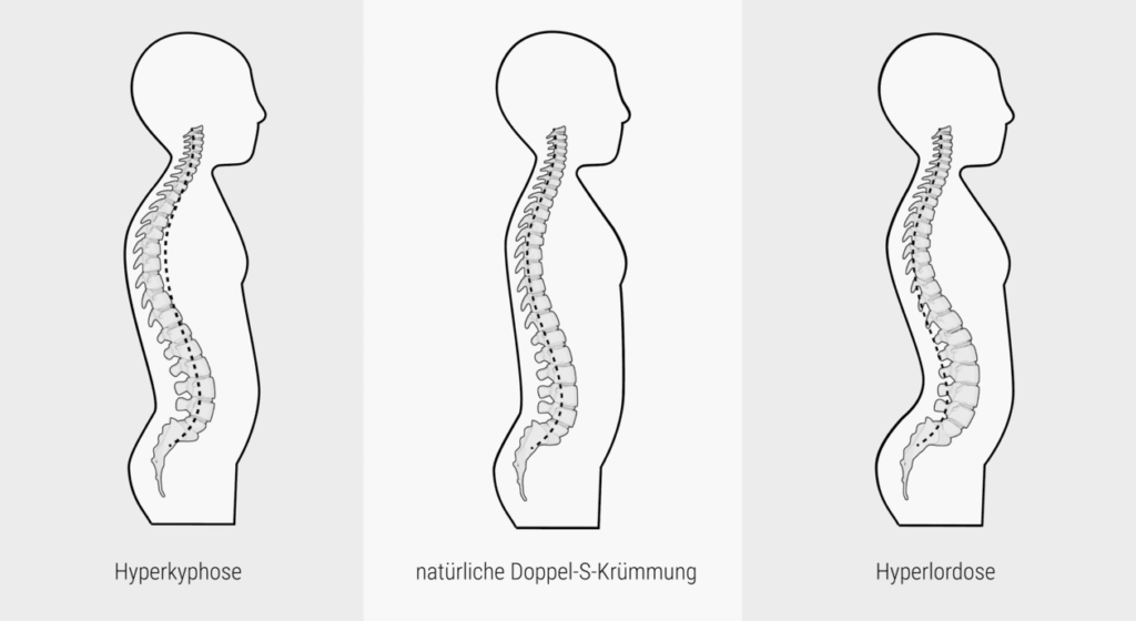 Lordose und Kyphose: natürliche Wirbelsäulenkrümmung - Wir sind Matratze