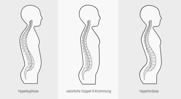 Lordose und Kyphose: natürliche Wirbelsäulenkrümmung - Wir sind Matratze